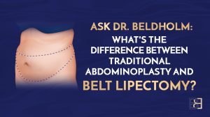 Your Complete Guide to Belt Lipectomy (Lower Body Lift) Surgery After ...